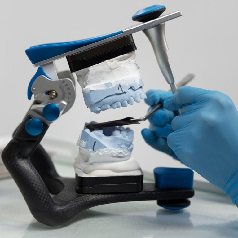 Clear Aligner Treatment Planning: Step-by-Step Guide